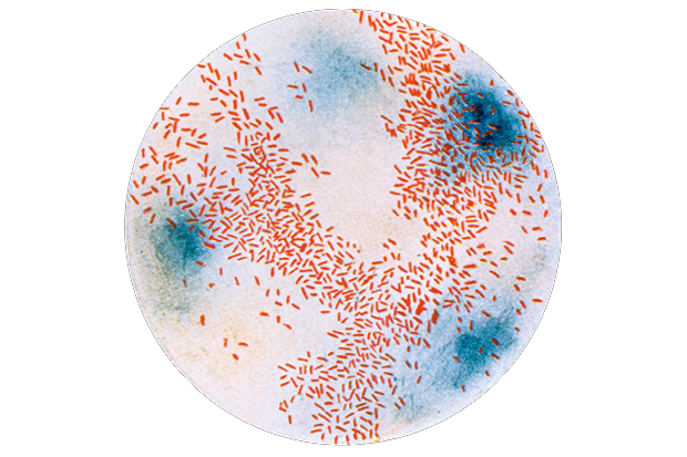 Of microbes and men | The Spectator Australia