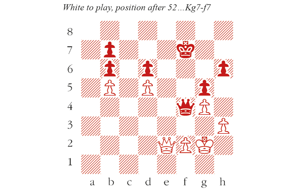 Bidding one’s time | The Spectator Australia