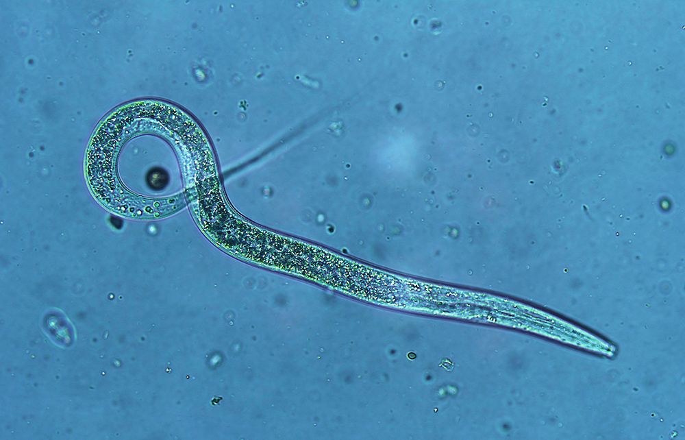 The worm has turned | The Spectator Australia