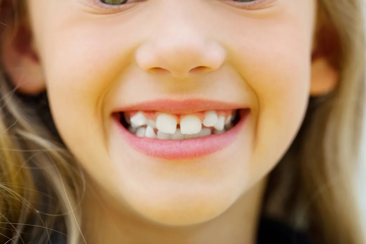 Are Americans too obsessed with their teeth? | The Spectator Australia